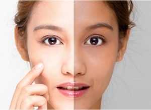 10 Unbelievable Uses and Benefits Of Glycerin For Skin and Face ...